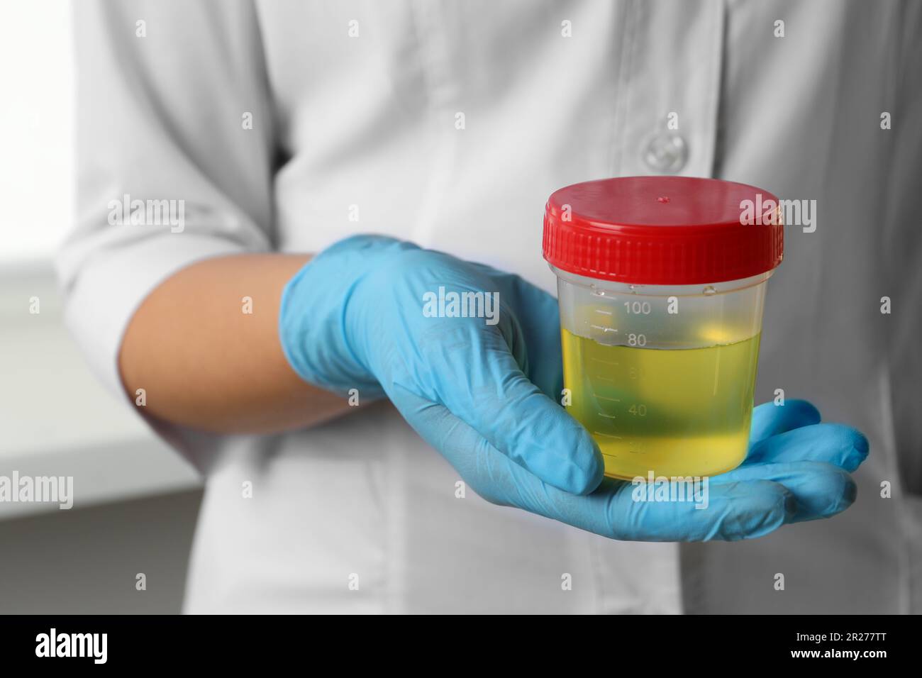 Doctor holding container with urine sample for analysis, closeup Stock ...