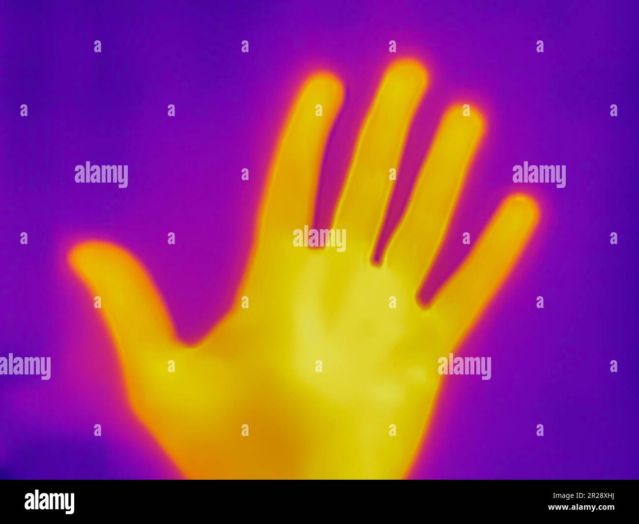 A thermal image of the palm of a hand captured with an infrared thermal ...