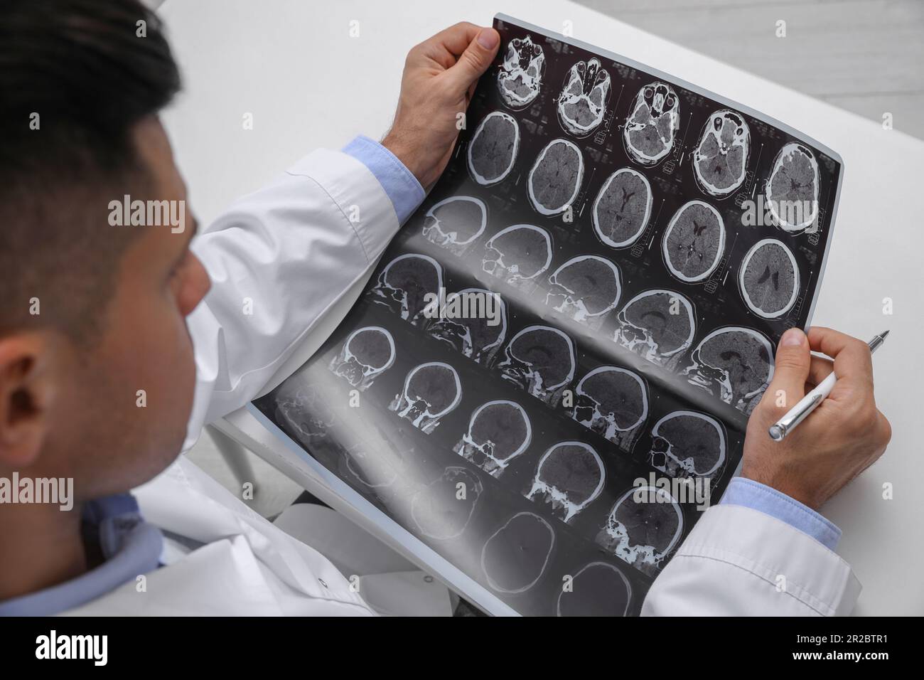 Doctor examining MRI images of patient with multiple sclerosis at white ...