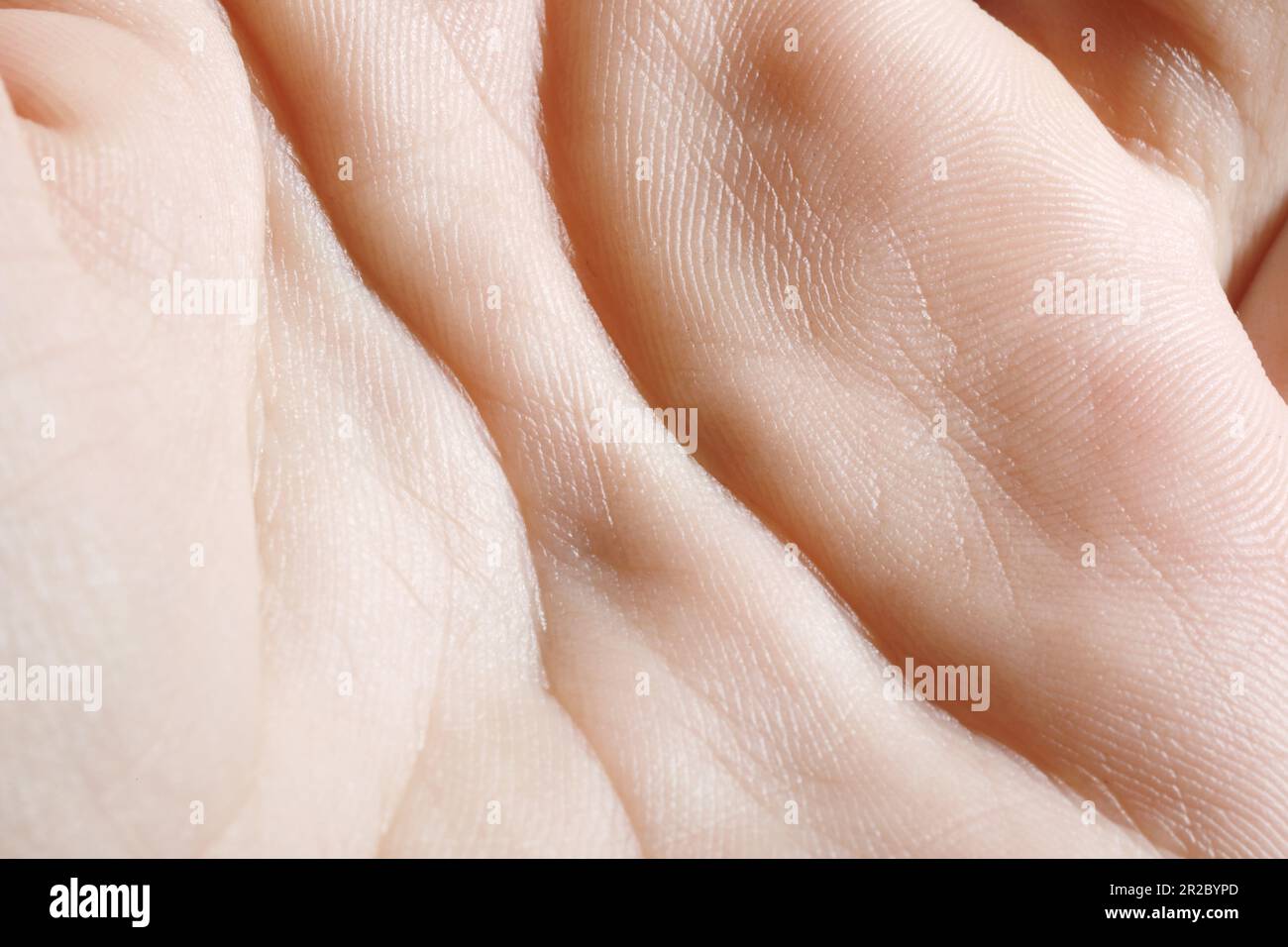 Closeup view of human hand with dry skin Stock Photo - Alamy