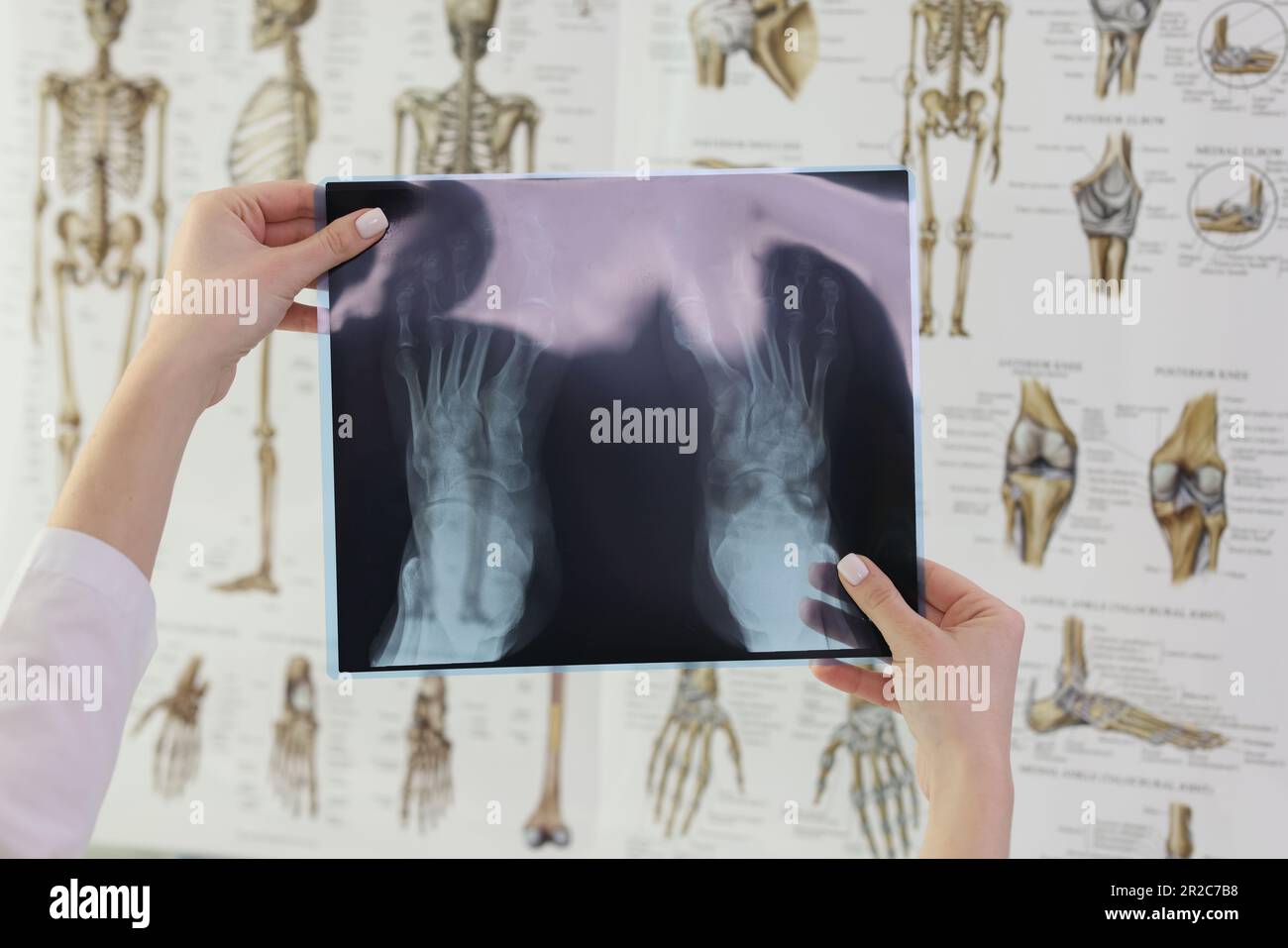 Doctor holds X-ray picture of patient feet in hospital Stock Photo - Alamy