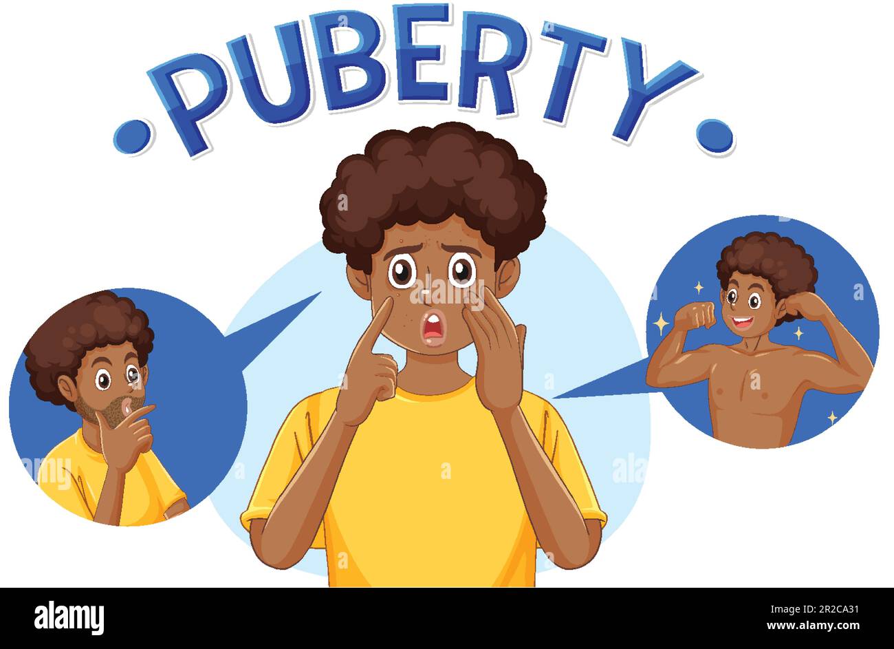 Teenage Boy with Skin Problem illustration Stock Vector Image & Art - Alamy