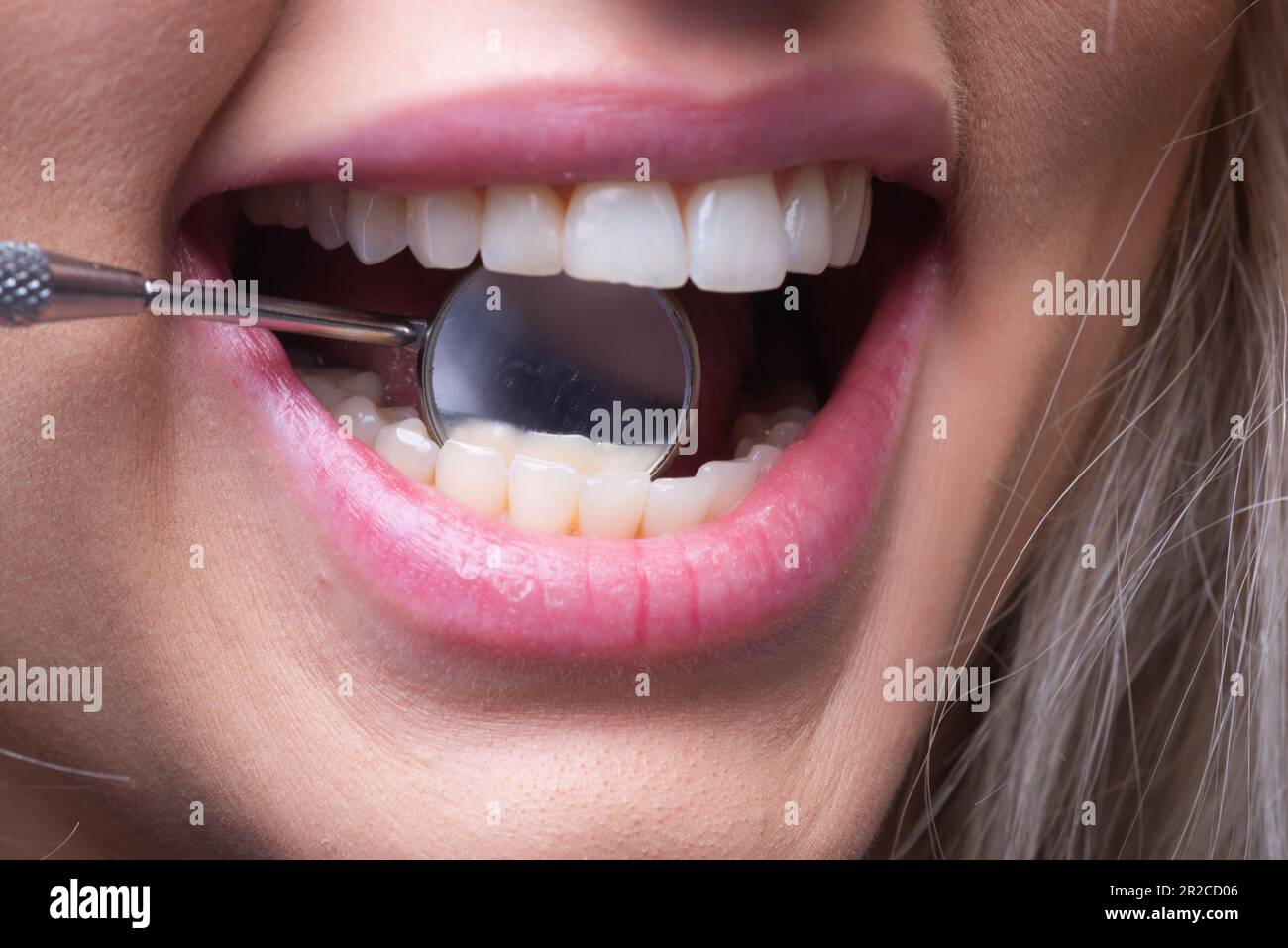 Dentist teeth mirror close-up. Examination of teeth with dental mirror ...