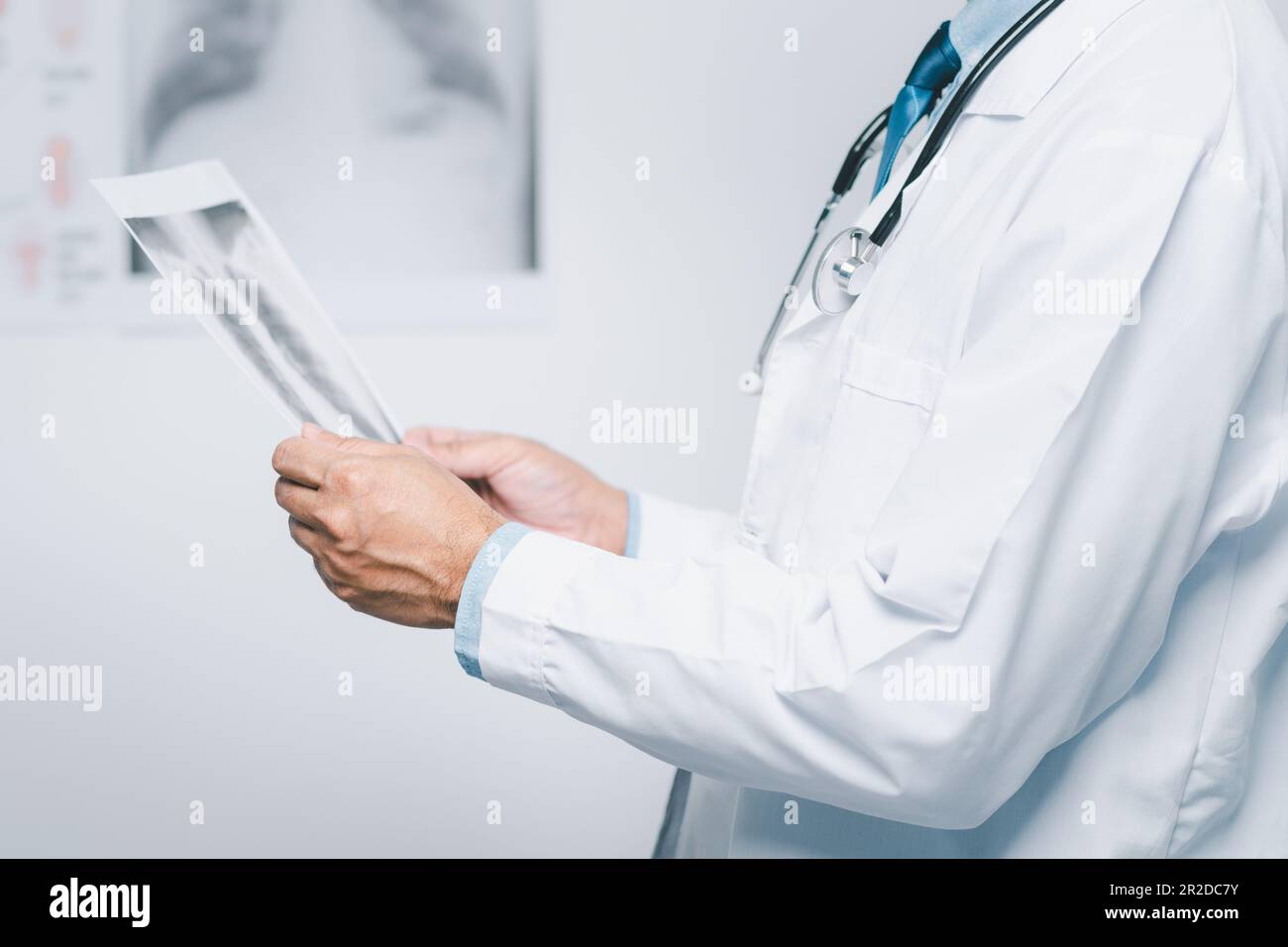 doctor man holding film x-ray of lung for checking lung disease in ...