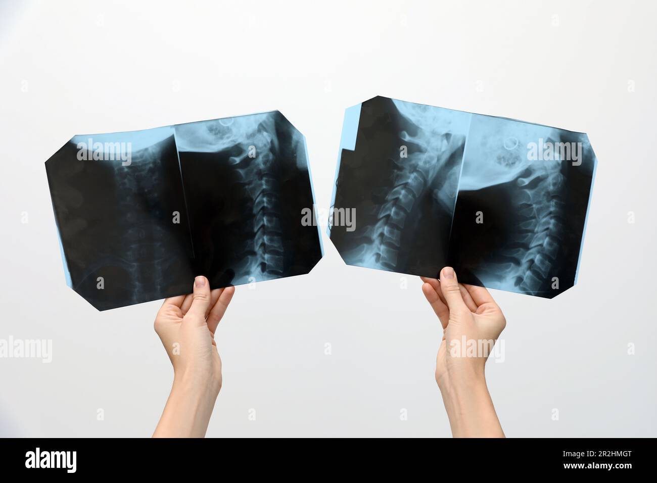 Doctor examining neck MRI images on light grey background, closeup ...