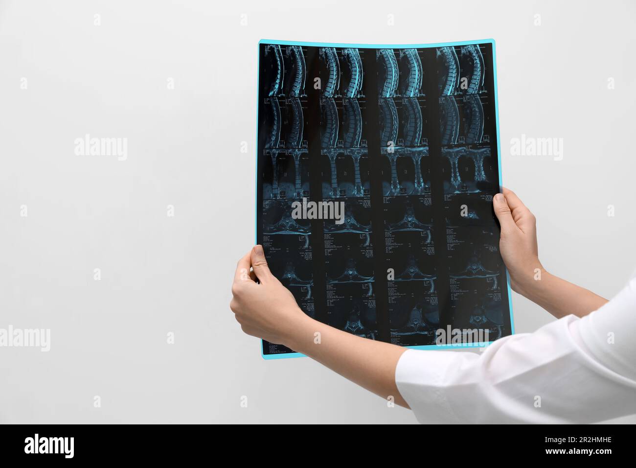 Doctor examining neck MRI image on light grey background, closeup Stock ...