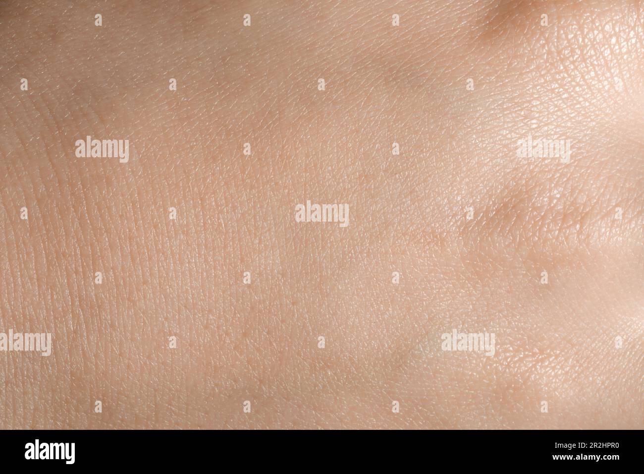Closeup view of dry human skin as background Stock Photo - Alamy