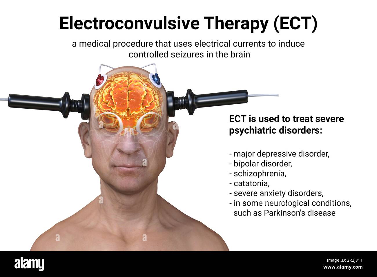 Old shock therapy hi-res stock photography and images - Alamy