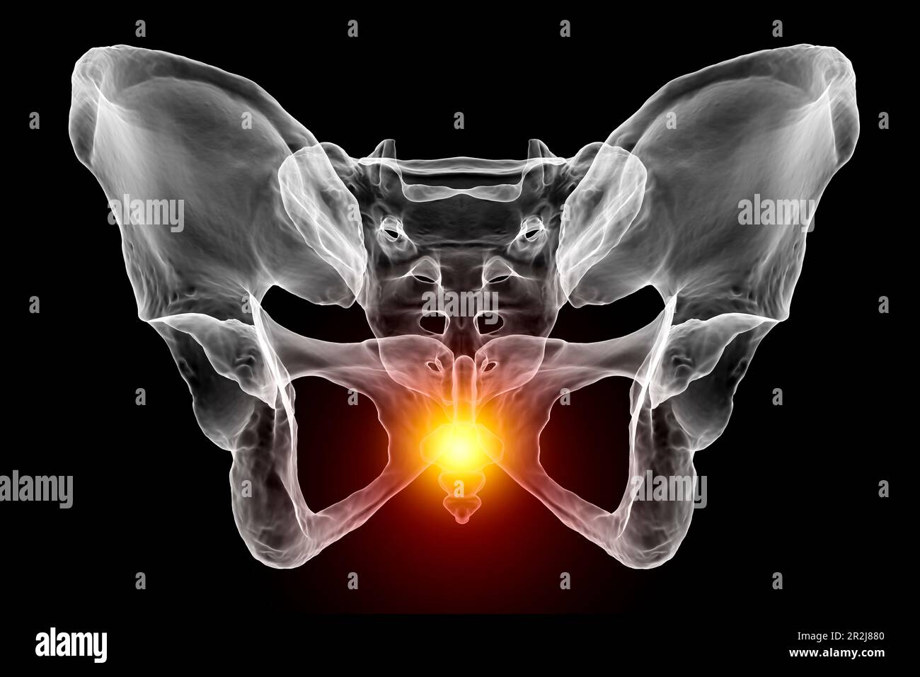 Coccyx pain, conceptual illustration Stock Photo - Alamy