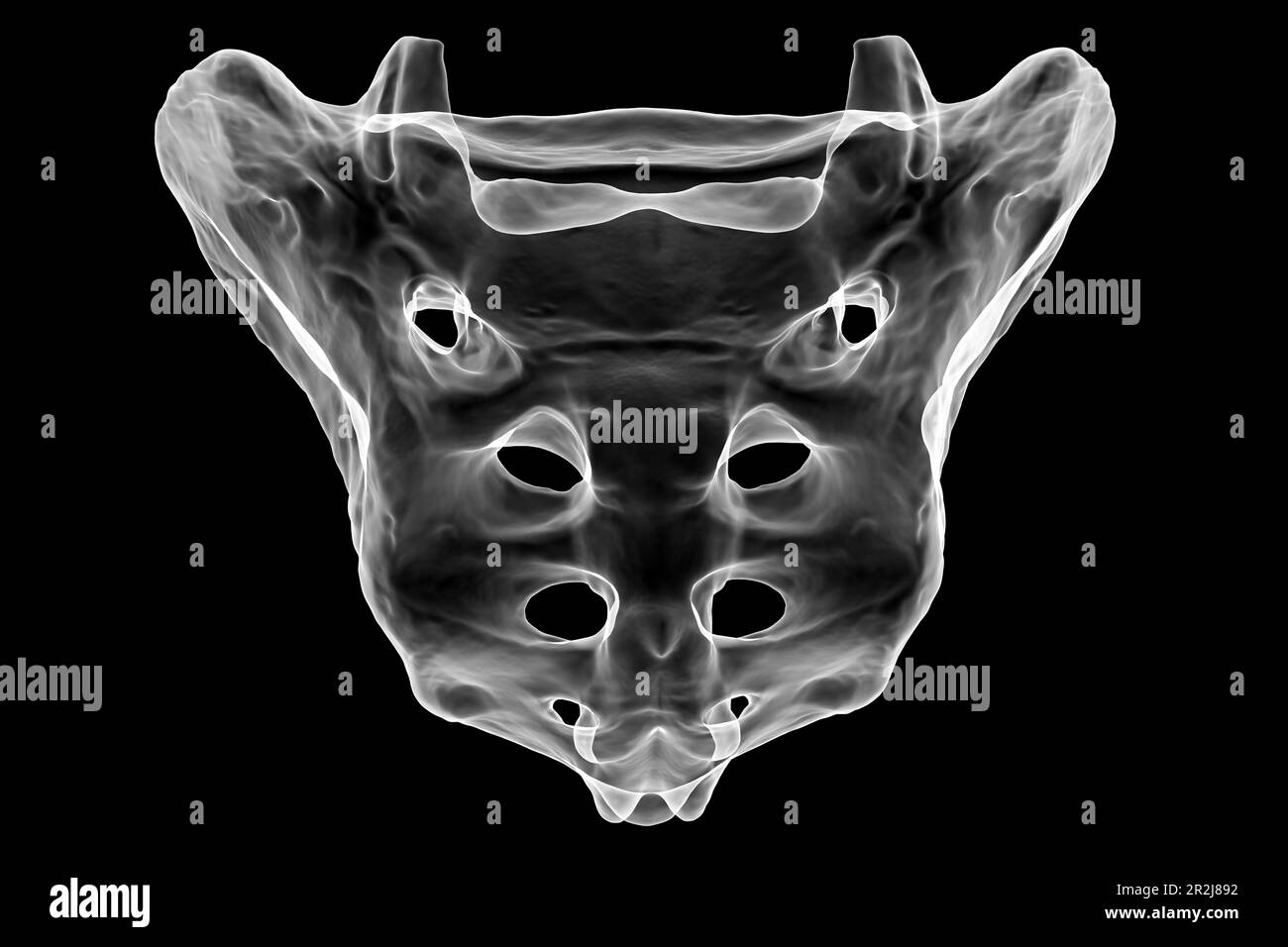 Sacrum fracture hi-res stock photography and images - Alamy