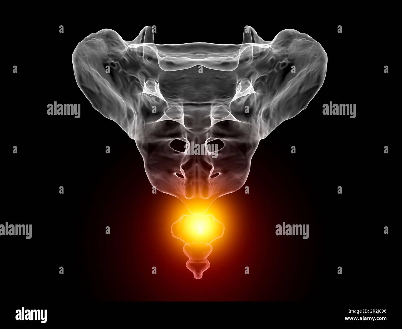 Coccyx pain, conceptual illustration Stock Photo - Alamy
