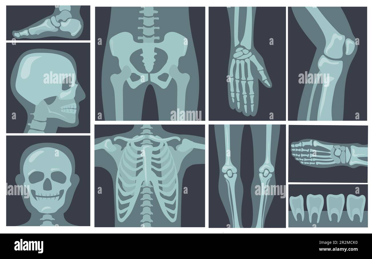 X-ray shots of human body Stock Vector Image & Art - Alamy