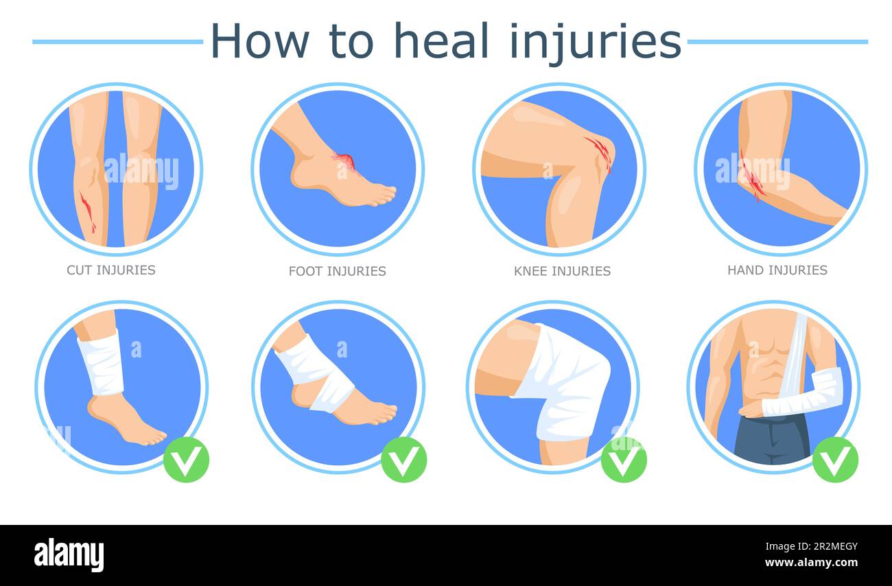 Hand with injuries Stock Vector Images - Alamy