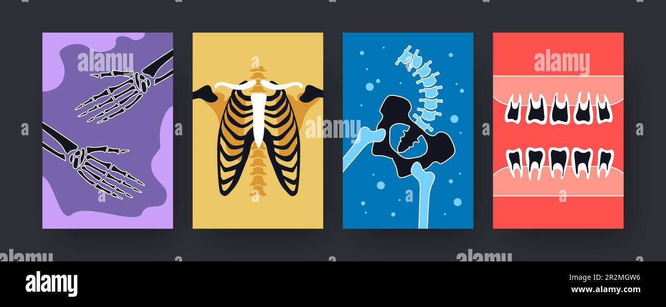 Set of contemporary art posters with X-ray shots of human body Stock ...