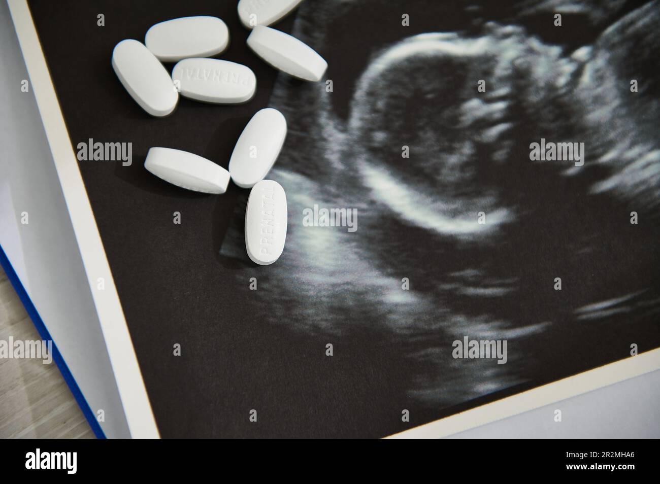 Pills for pregnant women with vitamins and microelements scattered over ...