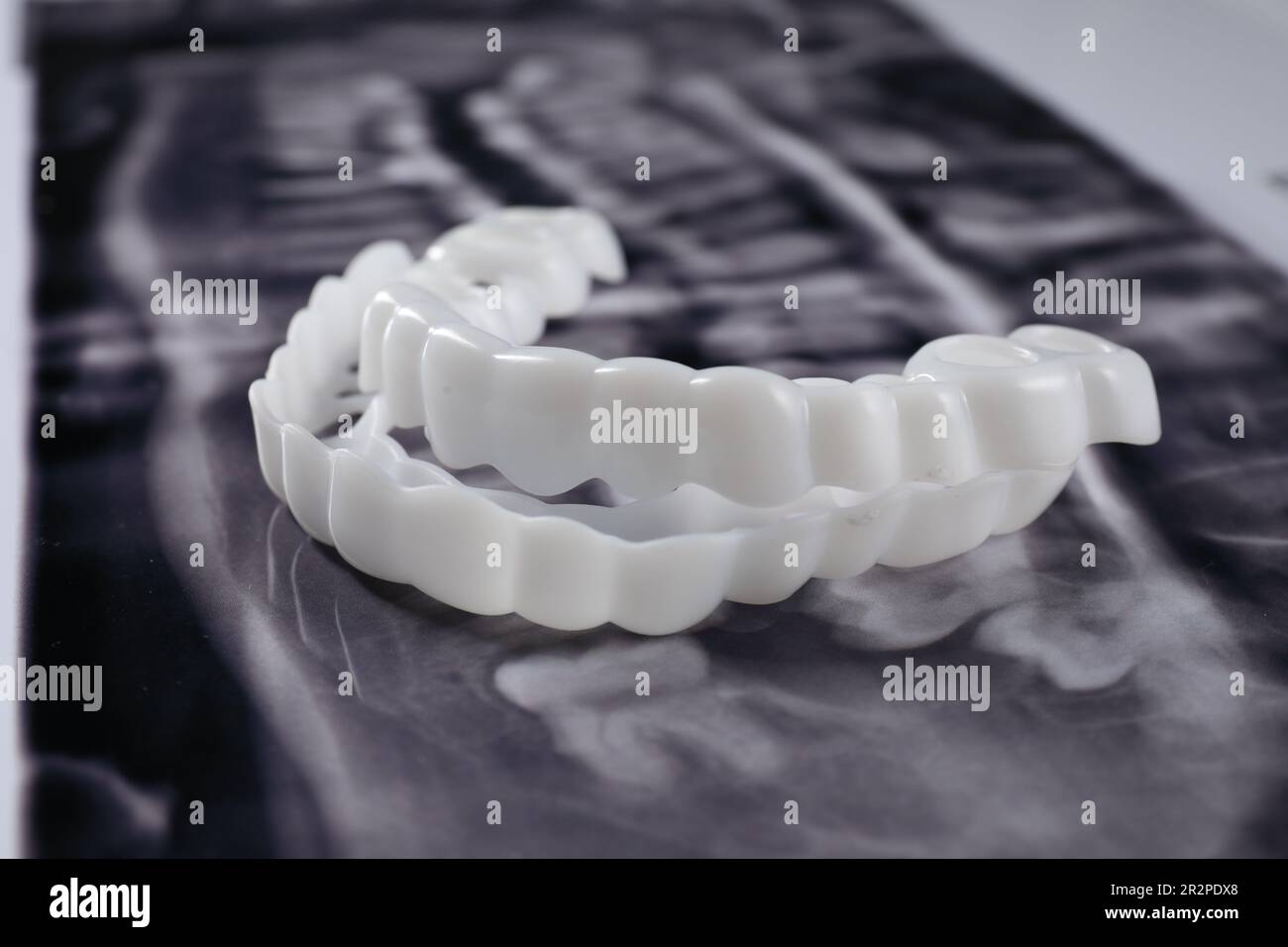 Dental scan hi-res stock photography and images - Alamy