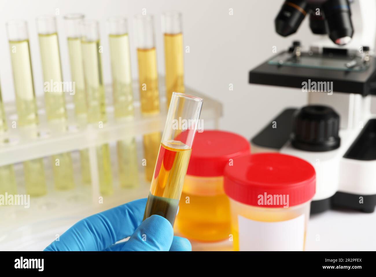 Nurse holding tube with urine sample for analysis in laboratory ...
