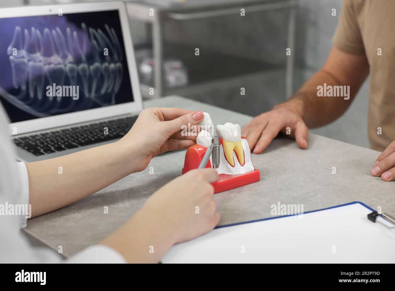 Doctor showing patient educational model of dental implant in clinic ...