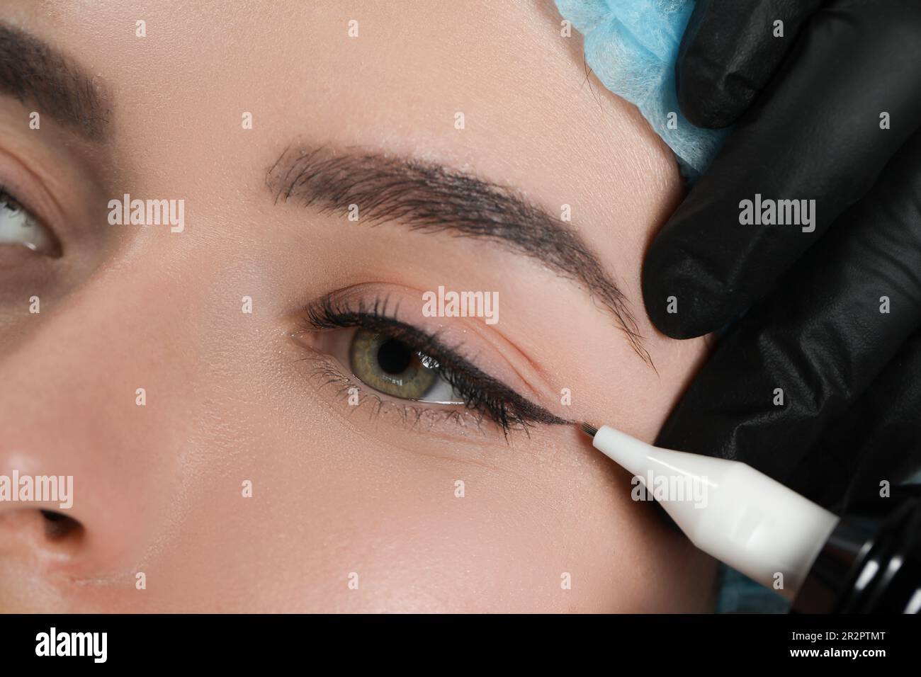 Procedure of permanent hi-res stock photography and images - Alamy