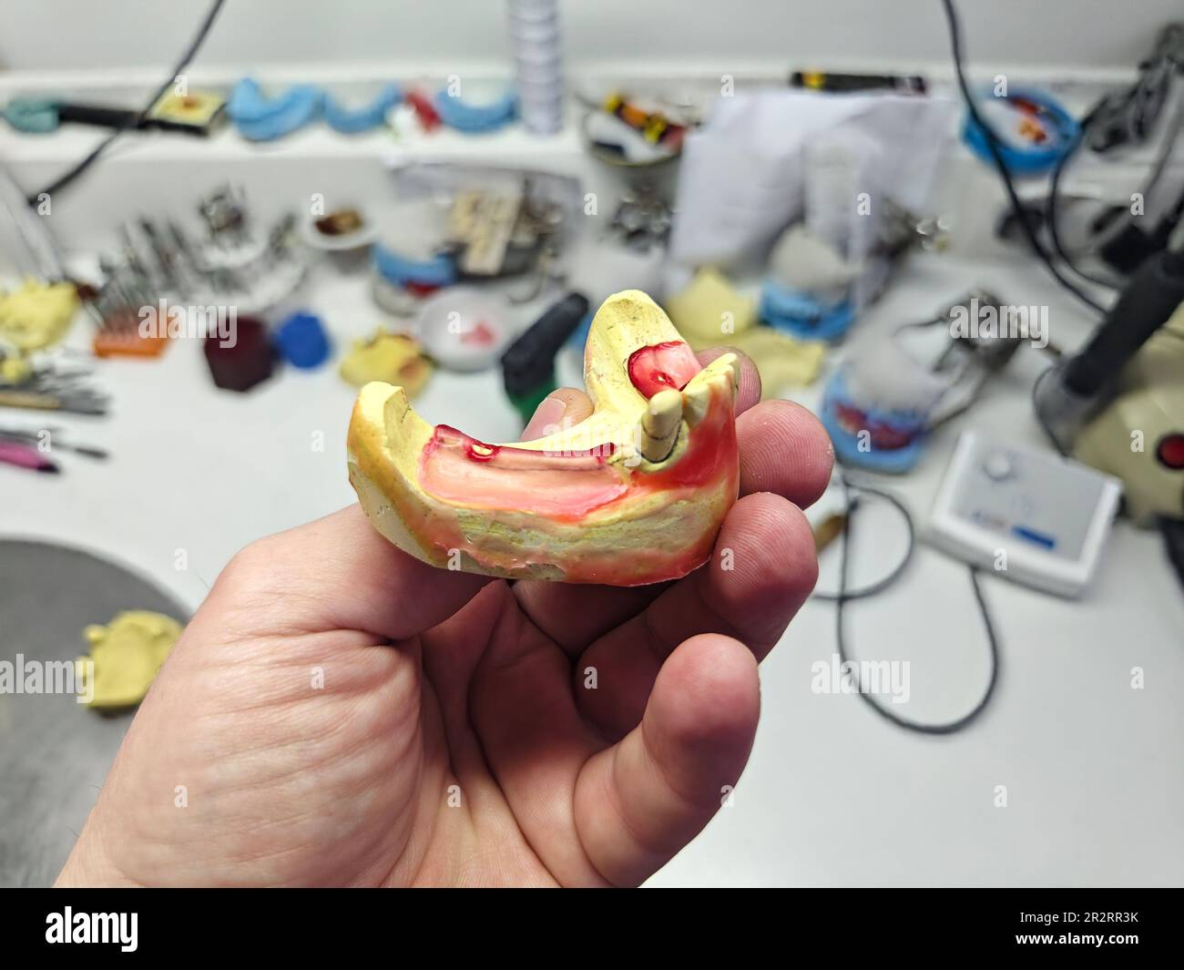 Wax dentures model table of dental technician workplace Stock Photo - Alamy