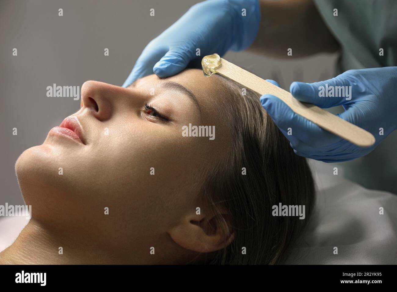 Young woman undergoing hair removal procedure on face with sugaring ...