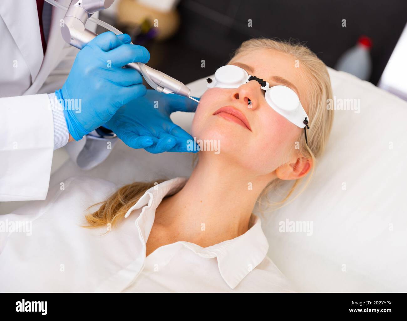 Female client receiving face skin laser resurfacing at cosmetology ...