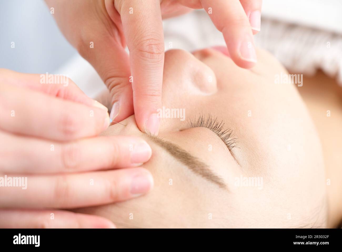 Acupuncture points hi-res stock photography and images - Alamy