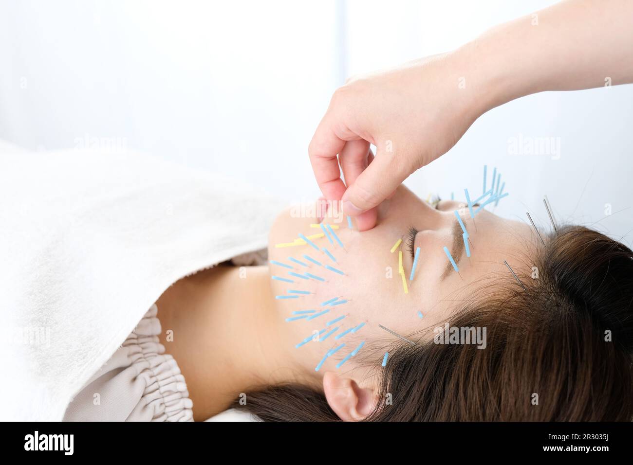 Hands of women and practitioners whose face is acupunctured Stock Photo ...