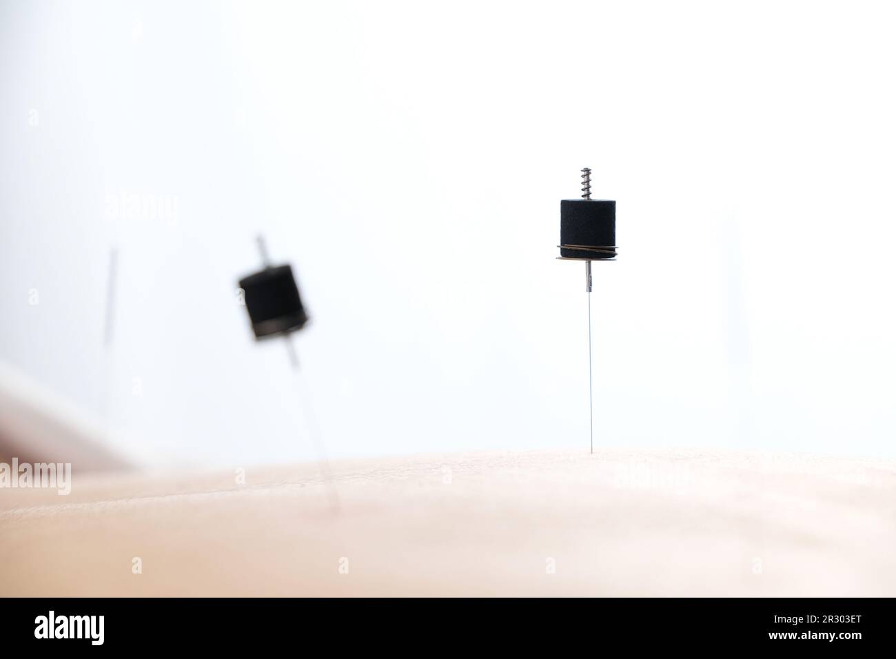 A woman with a needle stuck to her back at a bright acupuncture clinic ...