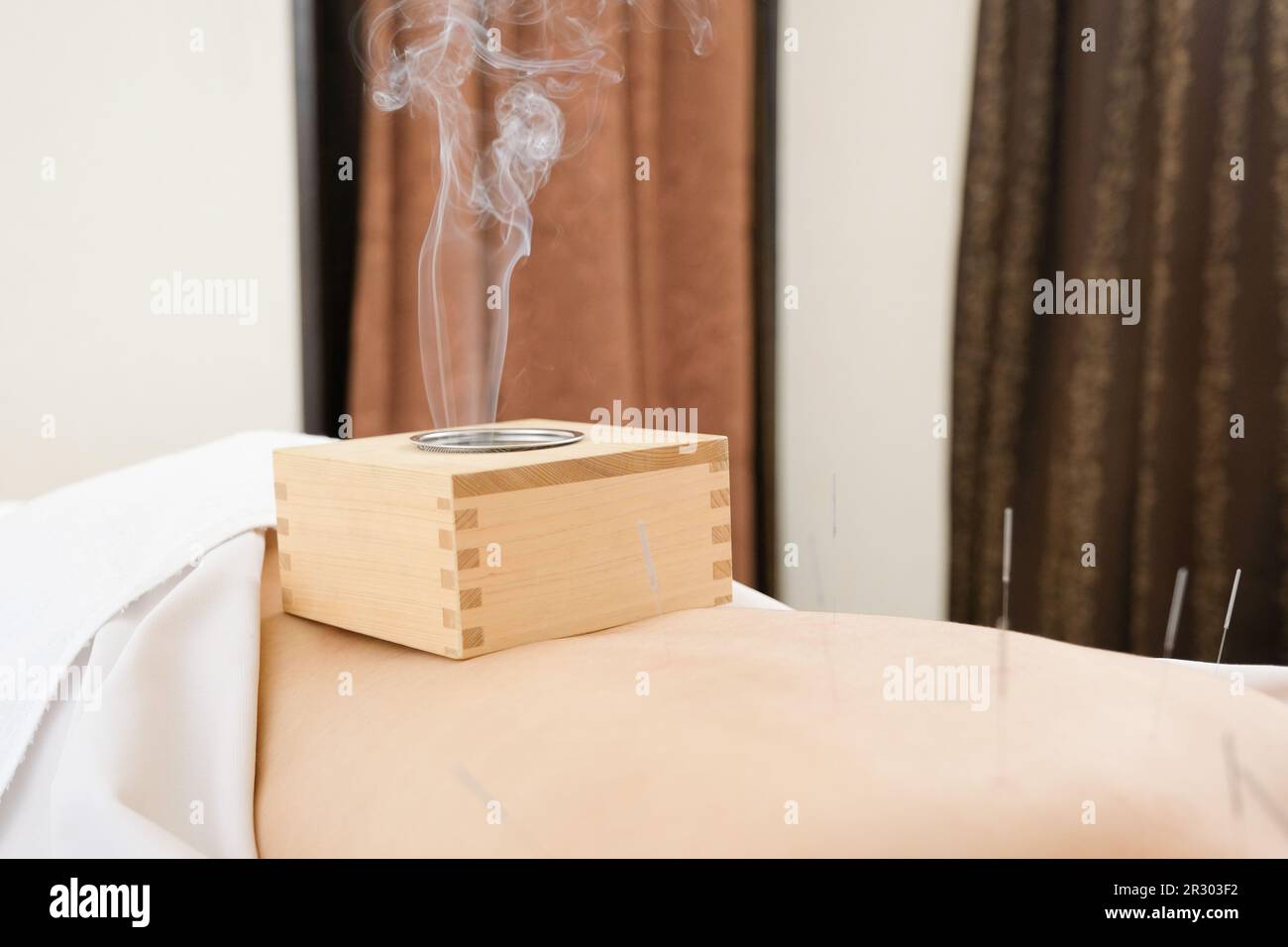 Box moxibustion placed on a woman's waist in a bright acupuncture ...