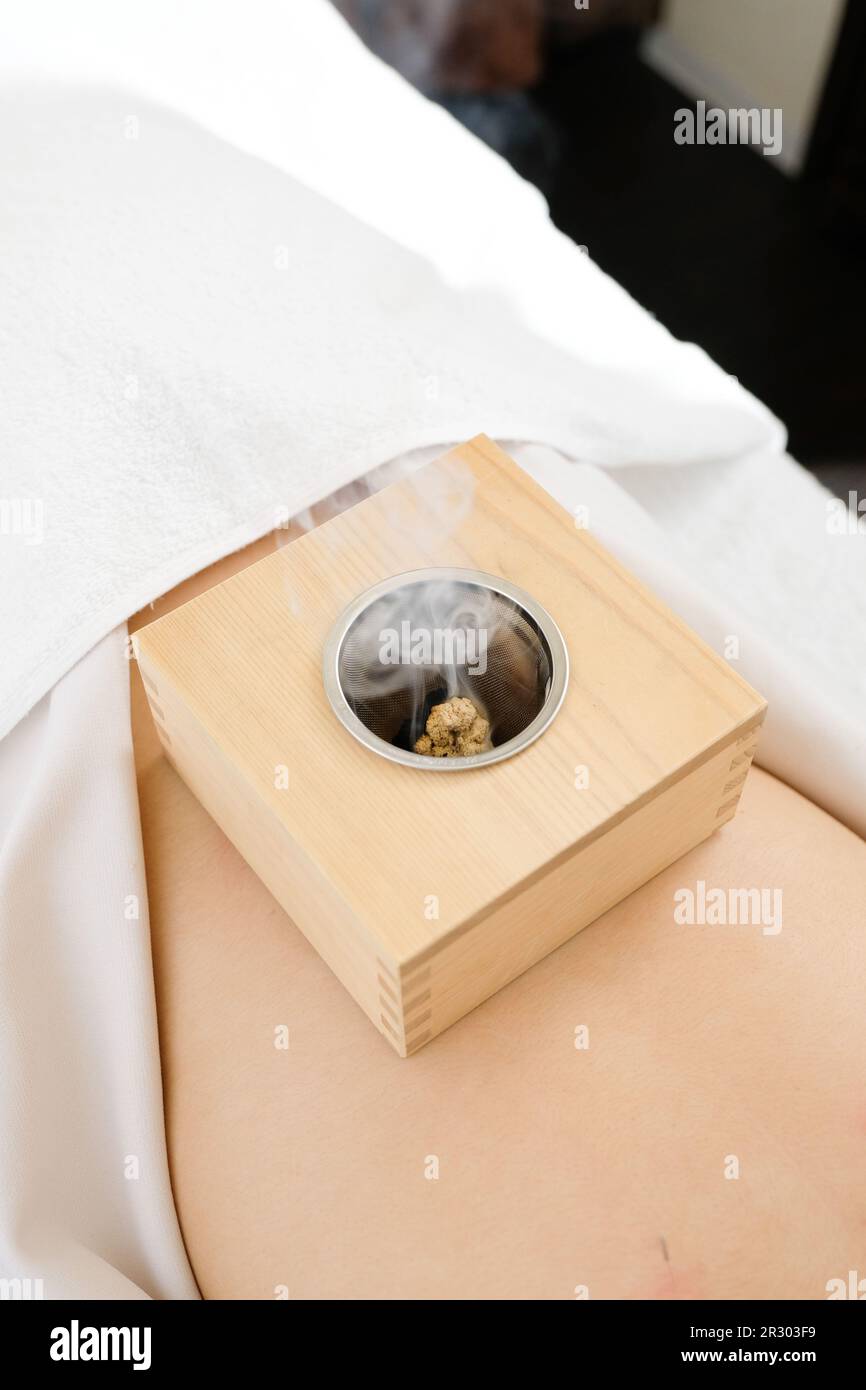 Box moxibustion placed on a woman's waist in a bright acupuncture ...
