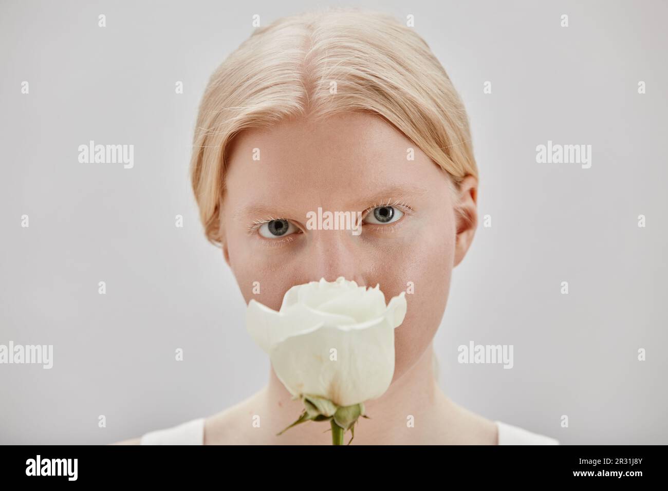 Girl with albinism hi-res stock photography and images - Alamy