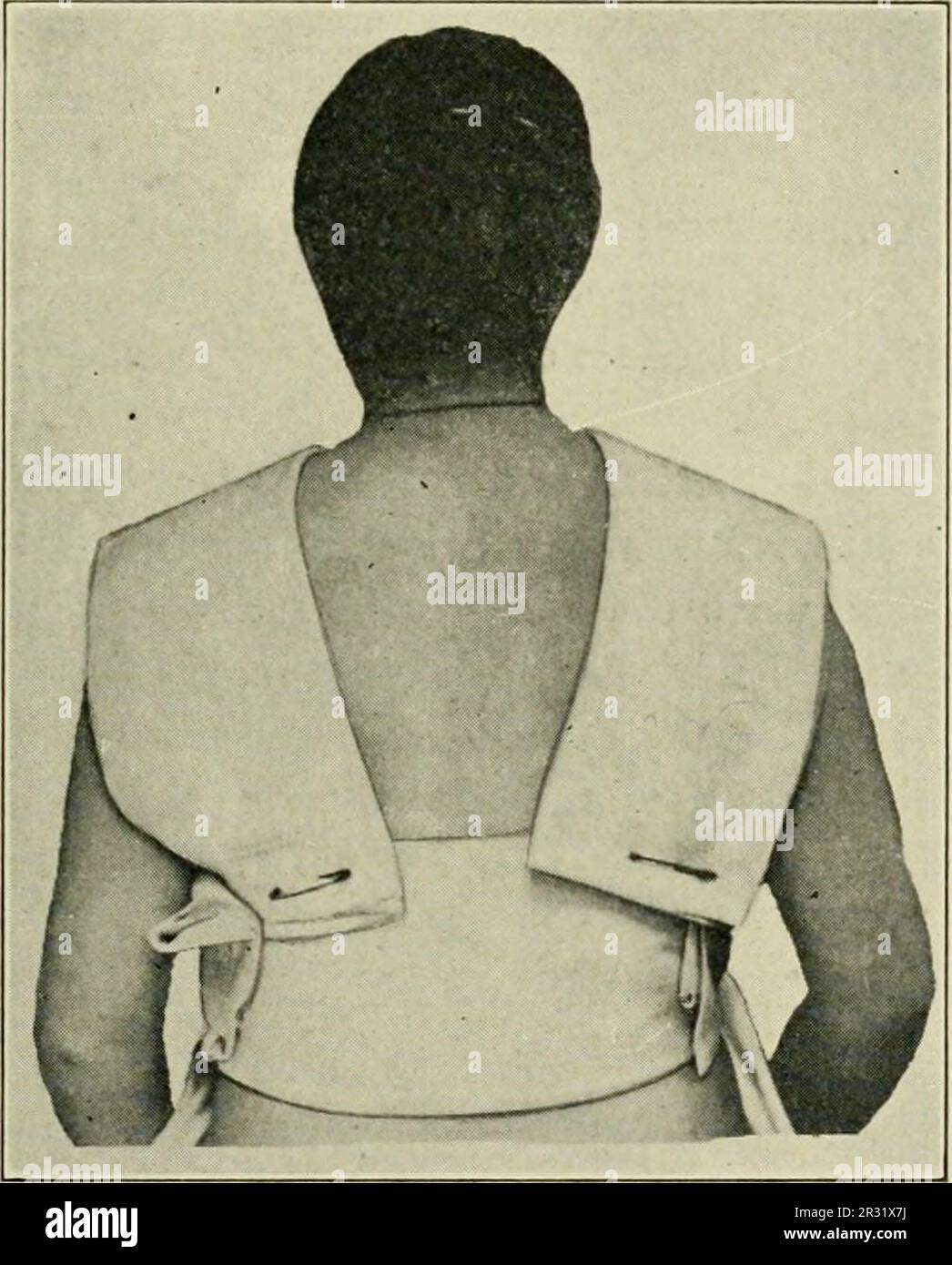"Obstetrics for nurses" (1922 Stock Photo - Alamy