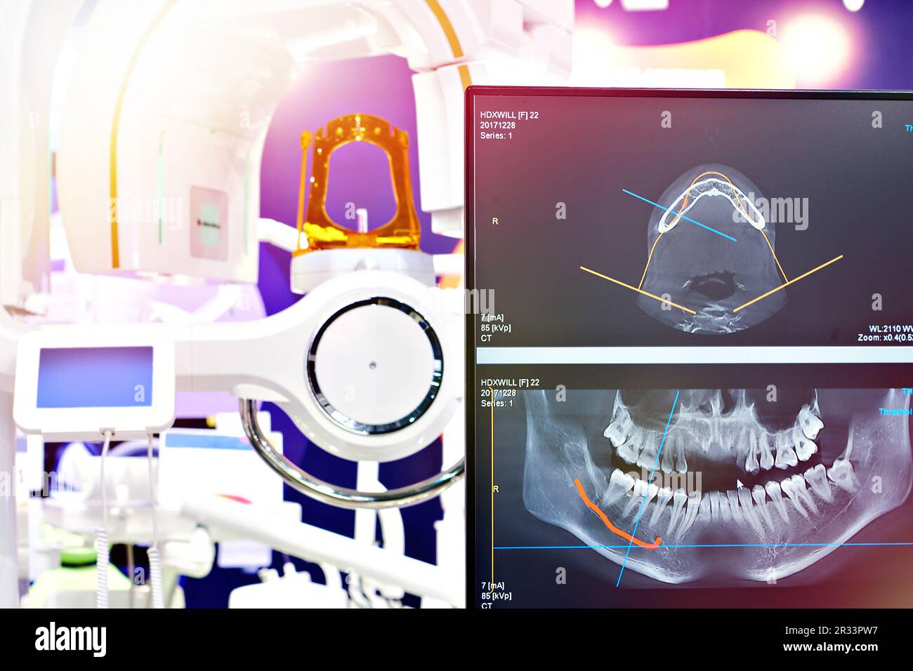 Modern dental digital 3D tomograph Stock Photo - Alamy