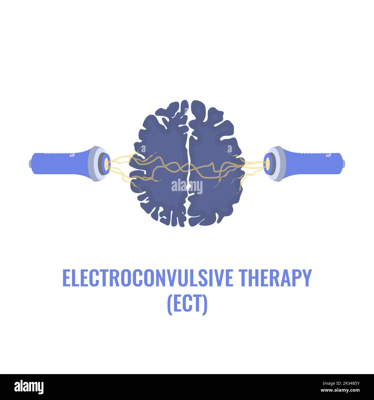 ECT electroconvulsive therapy for severe depression treatment Stock ...