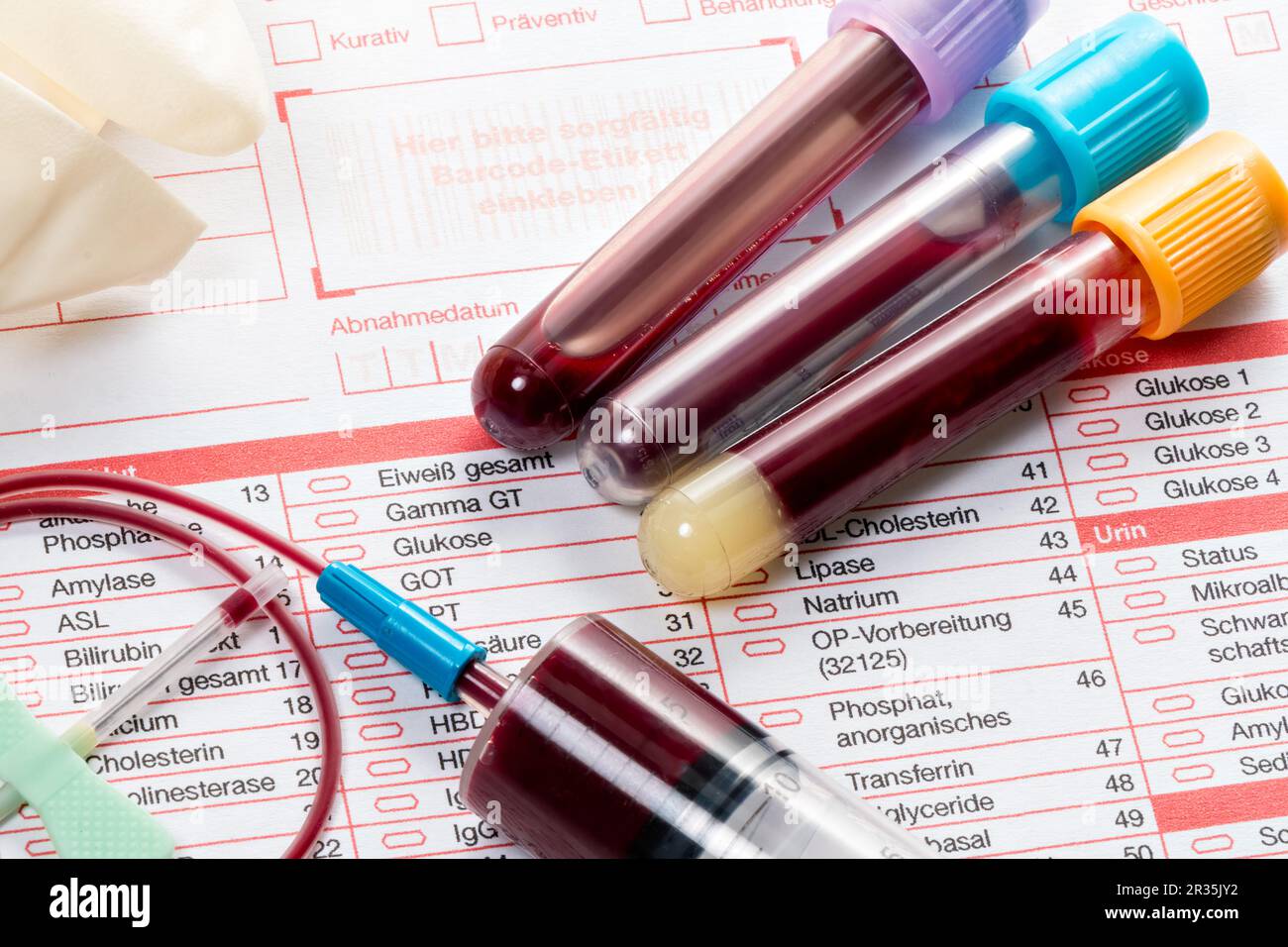 Blood test, blood samples on a laboratory form Stock Photo - Alamy