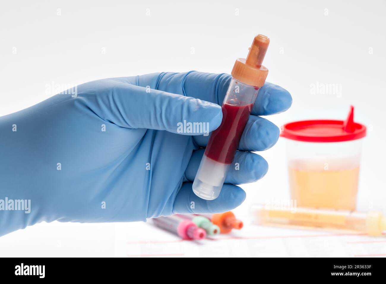 Urine and blood test (complete blood count Stock Photo - Alamy