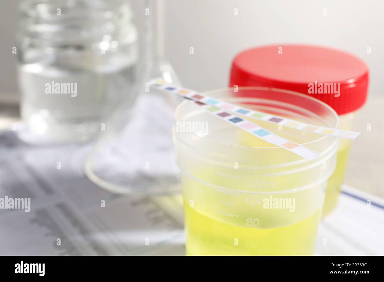 Containers with urine samples for analysis and glassware on test forms ...