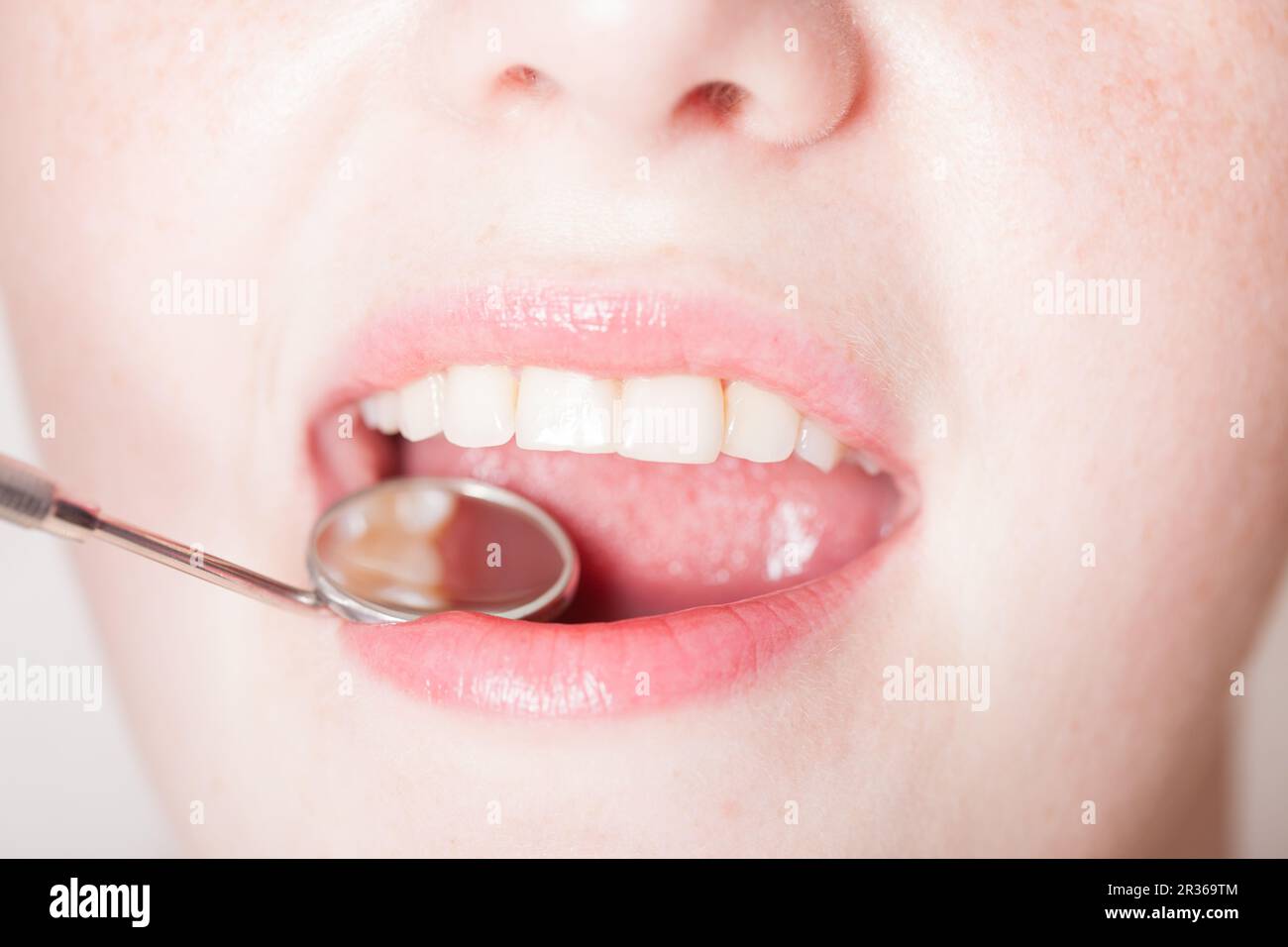 Check the teeth Stock Photo - Alamy