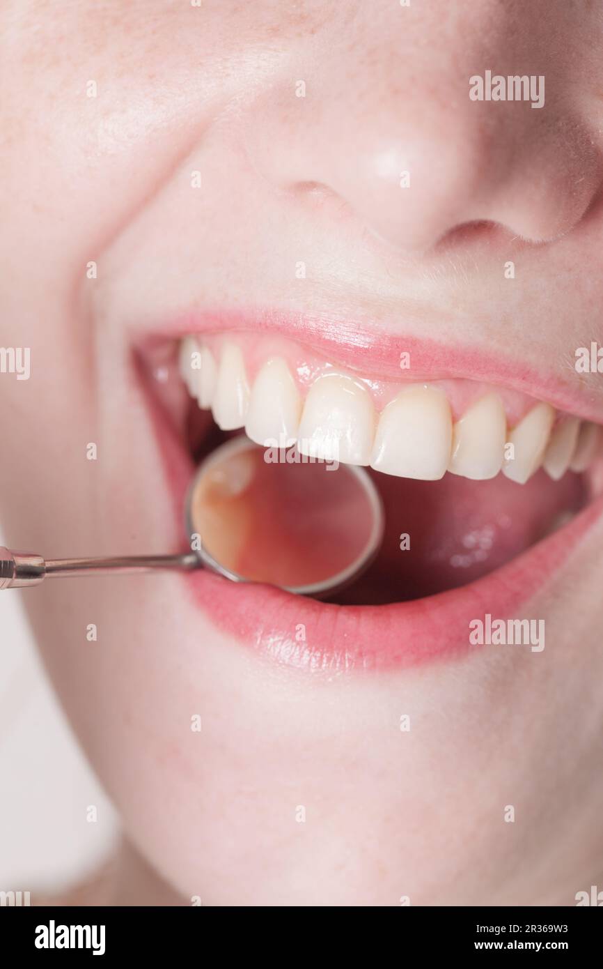 Check the teeth Stock Photo - Alamy