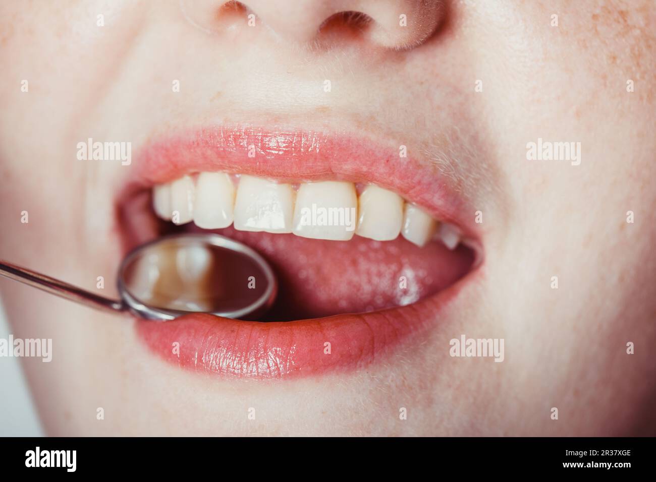 Check the teeth Stock Photo - Alamy