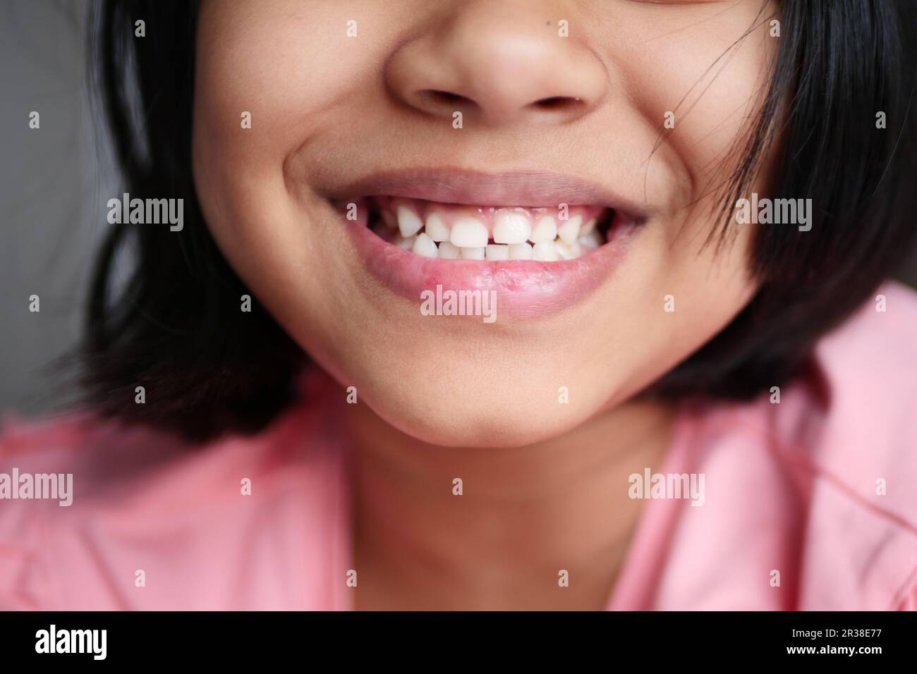 child smiling with healthy white teeth Stock Photo - Alamy