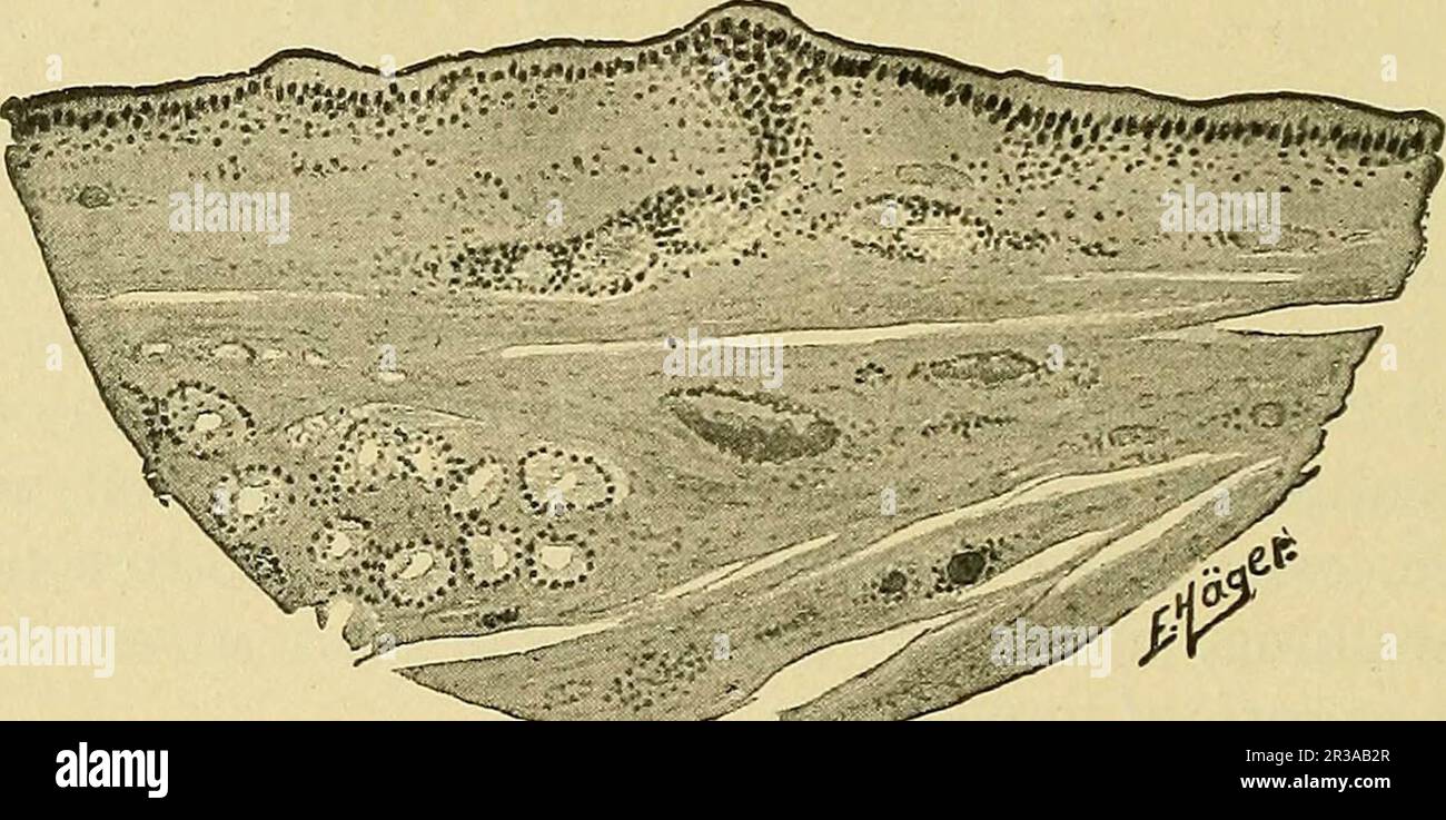 "Pathology and treatment of diseases of women" (1912 Stock Photo - Alamy