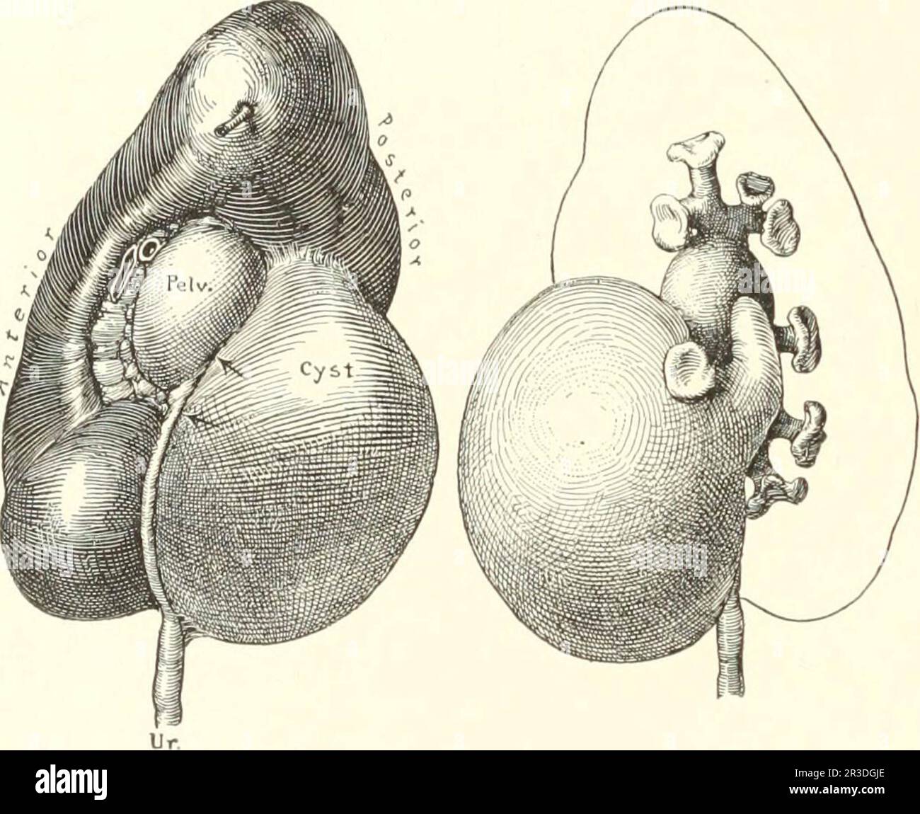 "Diseases of the kidneys, ureters and bladder, with special reference ...