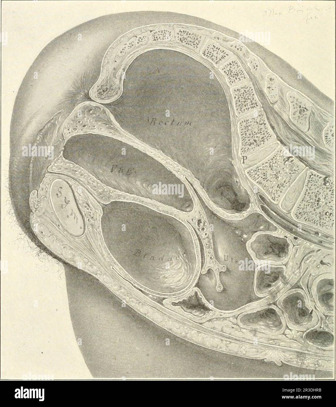 "Diseases of the kidneys, ureters and bladder, with special reference ...