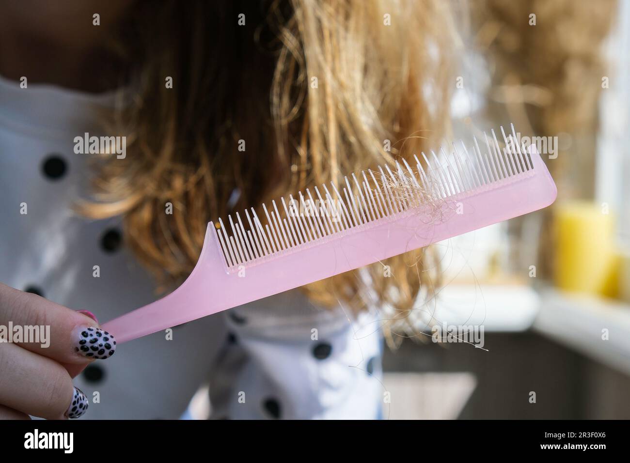 Worried woman holding brush with hair loss after brushing. Clump of ...