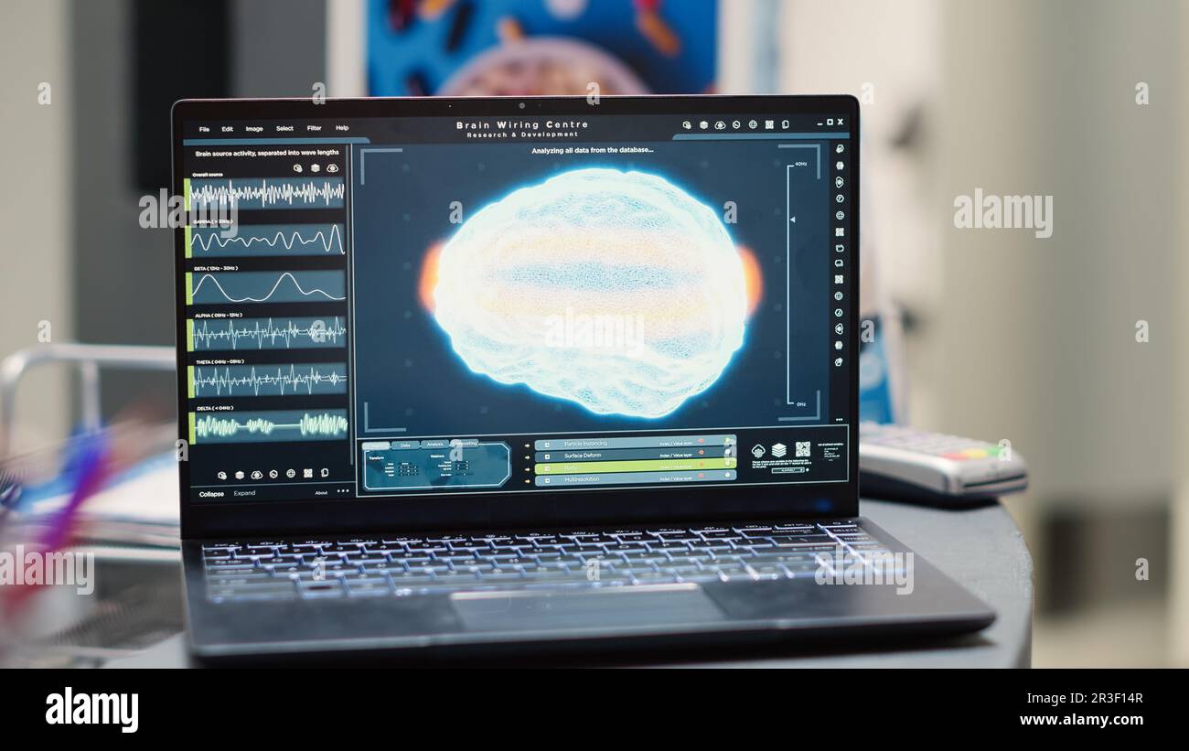 Laptop displaying human brain diagnosis Stock Photo - Alamy