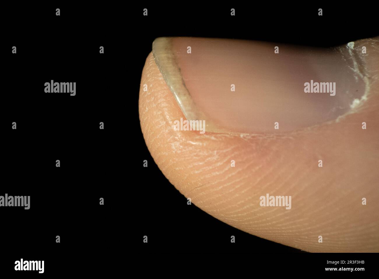 Toenail hi-res stock photography and images - Alamy