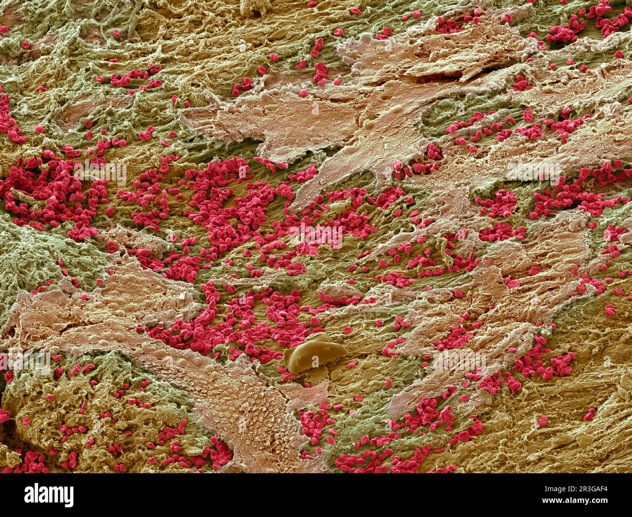 Uterus during menstruation, SEM Stock Photo - Alamy
