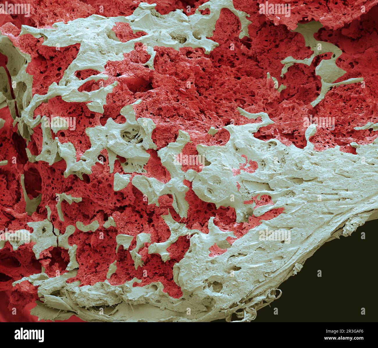 Bone marrow, SEM Stock Photo - Alamy